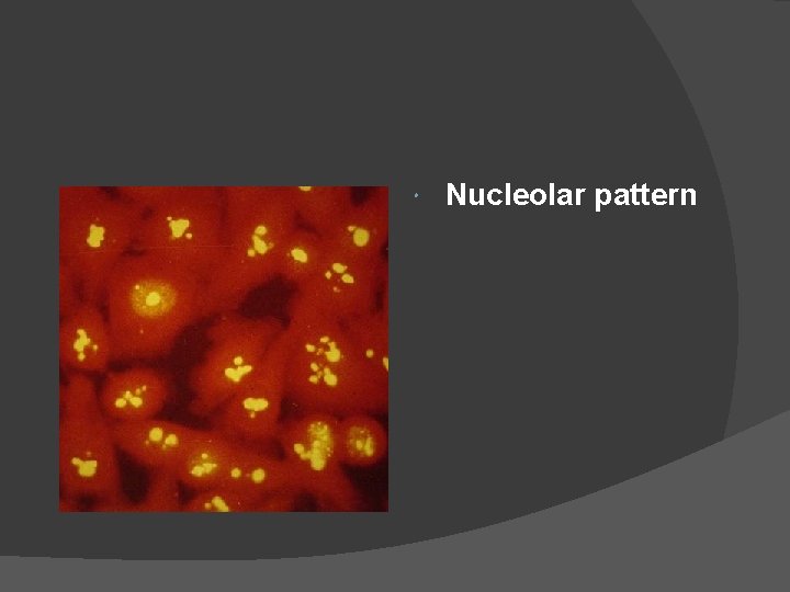 ANTIBODY PROFILE IN SYSTEMIC LUPUS ERYTHEMATOSUS Dr hani