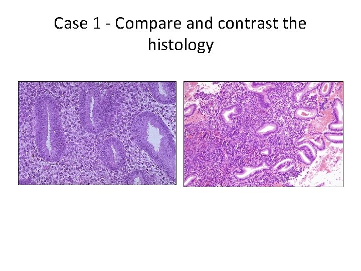 MHD II PATHOLOGY OF THE FEMALE REPRODUCTIVE SYSTEM
