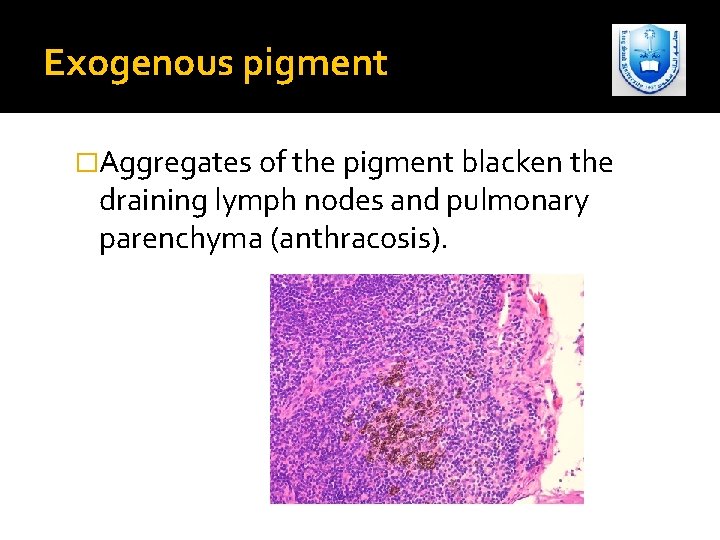 INTRACELLULAR ACCUMULATIONS and CALCIFICATION Foundation Block ...