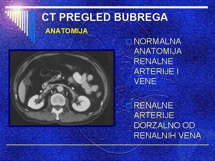 CT U DIJAGNOSTICI OBOLJENJA BUBREGA Prof dr Mira