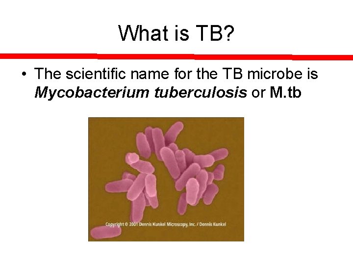 TB Basics Diagnosis Treatment and Prevention Workshop to