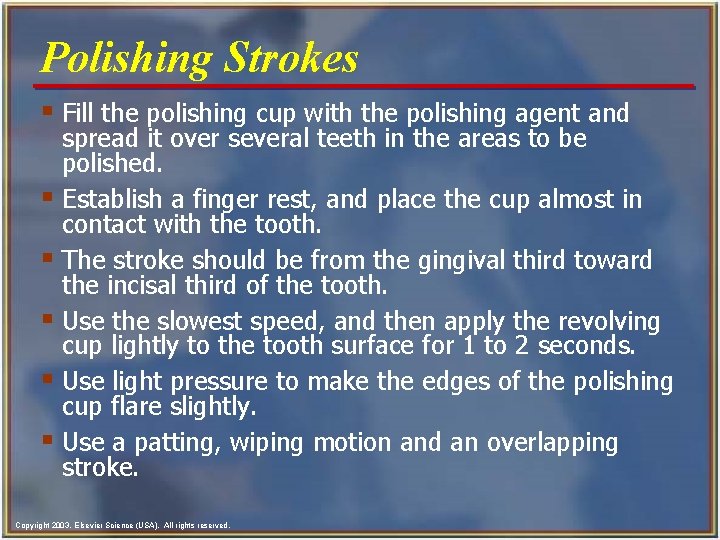 Chapter 58 Coronal Polish Copyright 2003 Elsevier Science