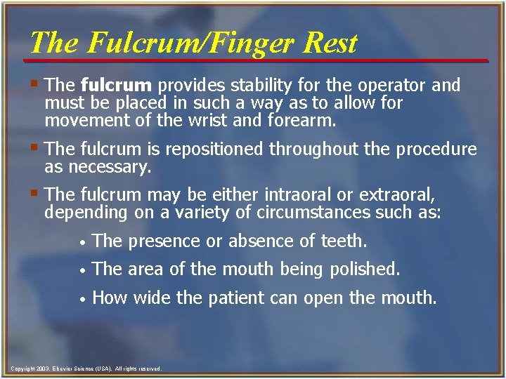 Chapter 58 Coronal Polish Copyright 2003 Elsevier Science