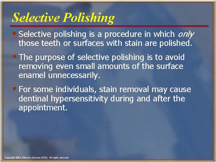 Chapter 58 Coronal Polish Copyright 2003 Elsevier Science