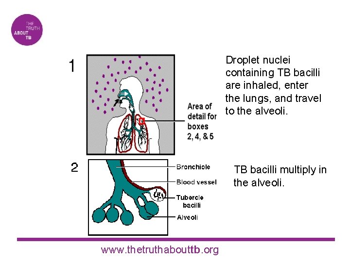 Tuberculosis management control and prevention Developed by In