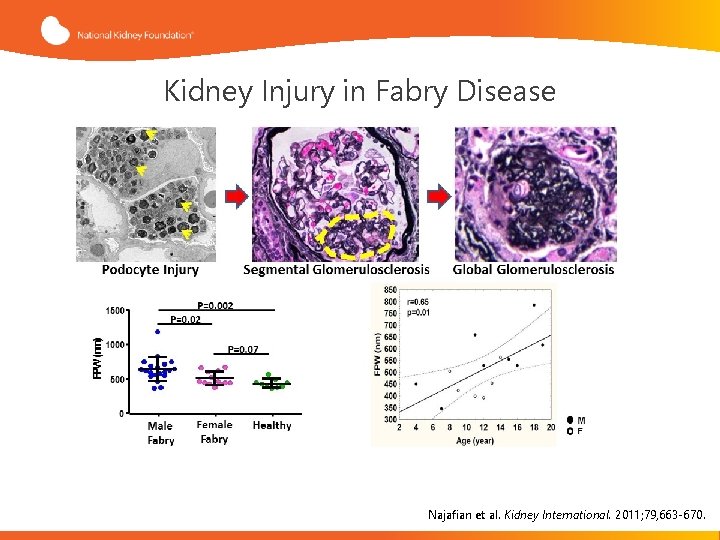 Evaluation and Management of Fabry Disease Supported by