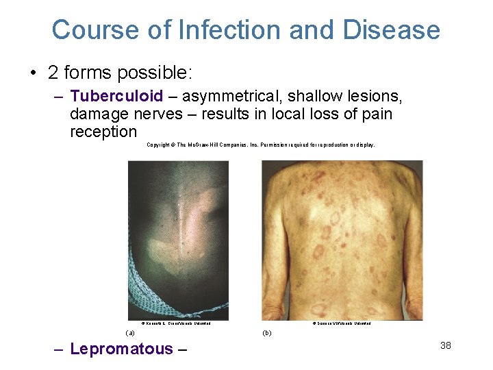Chapter 19 The GramPositive Bacilli of Medical Importance