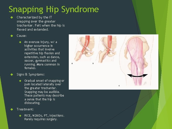 Injuries of the Thigh Hip Groin Pelvis Chapter