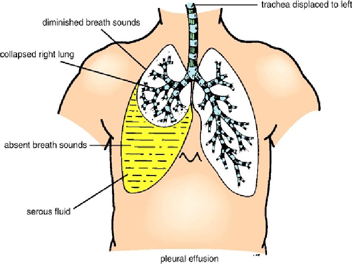 ANATOMY OF PLEURA Dr Mujahid Khan Location The