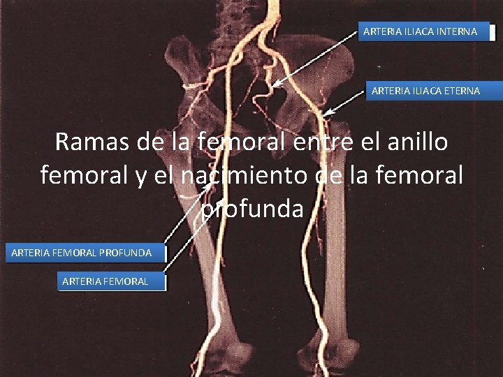 SISTEMA DE LA ARTERIA ILIACA EXTERNA VENAS DEL