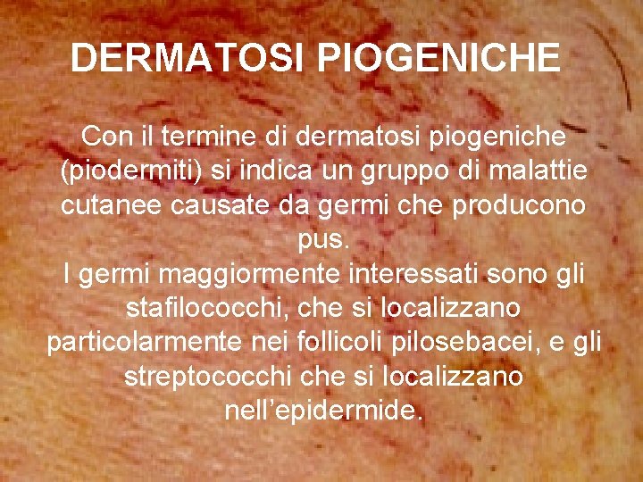 DERMATOSI PIOGENICHE Con il termine di dermatosi piogeniche