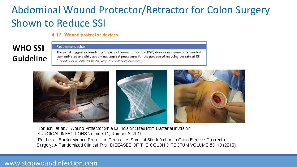 Prevention of Surgical Site Infection Using An Evidence