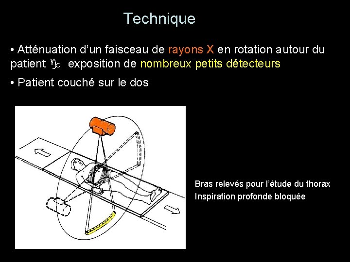 SCANNER THORACIQUE NORMAL MariePierre Debray Nicoletta Pasi Yal