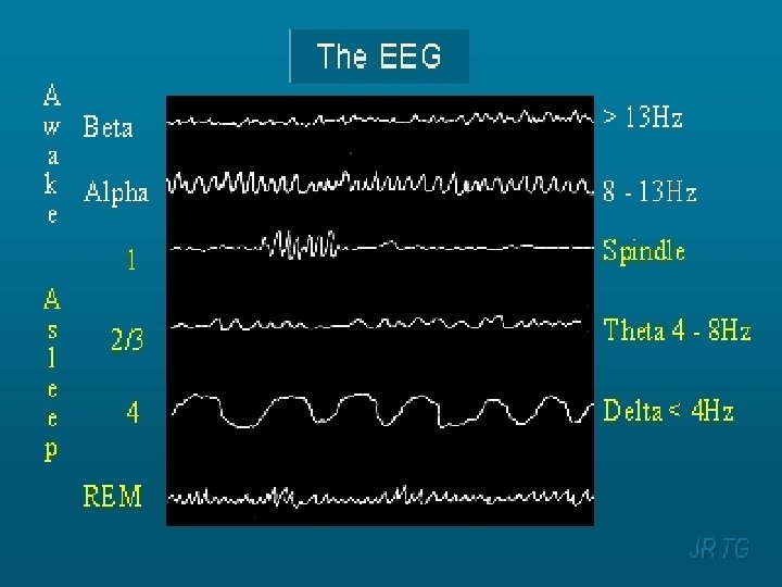 EEG Sono e Sonhos Eletroencefalograma EEG Hans Berger