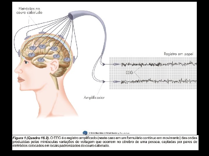 EEG Sono e Sonhos Eletroencefalograma EEG Hans Berger
