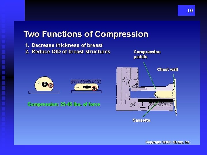 MAMMOGRAPHY LECTURE 1 rev 2010 Positioning Anatomy RADIOGRAPHIC