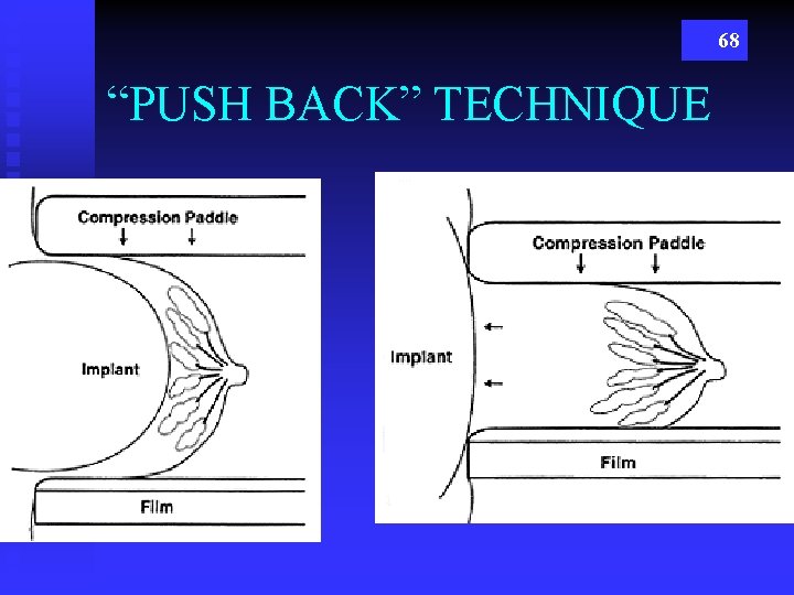 MAMMOGRAPHY LECTURE 1 rev 2010 Positioning Anatomy RADIOGRAPHIC