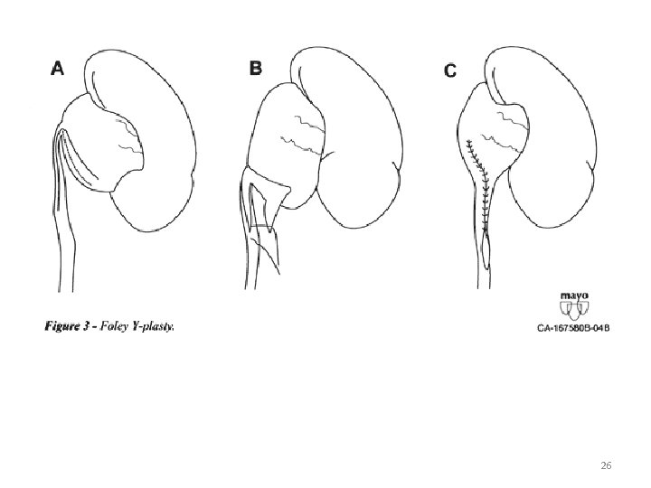 Urology 4 Hydronephrosis Contents Definition Etiology Pathology Clinical
