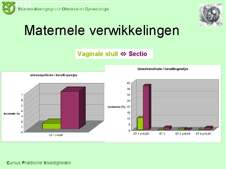 De Vaginale Stuitbevalling Cursus Praktische Vaardigheden Monika Laubach