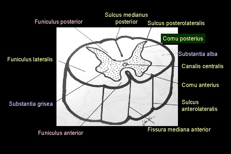MEDULLA SPNALS FONKSYONEL ANATOM ve HASTALIKLARI Erikinde L