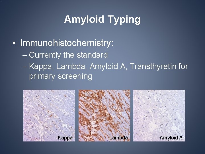 Pathologic Diagnosis in Amyloidosis JungSun Kim MD Ph