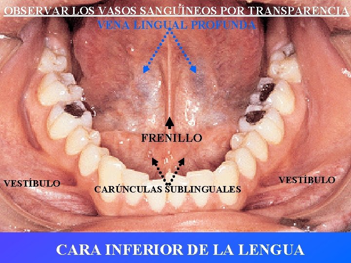 Tema 4 1 Vsceras de Cabeza y Cuello