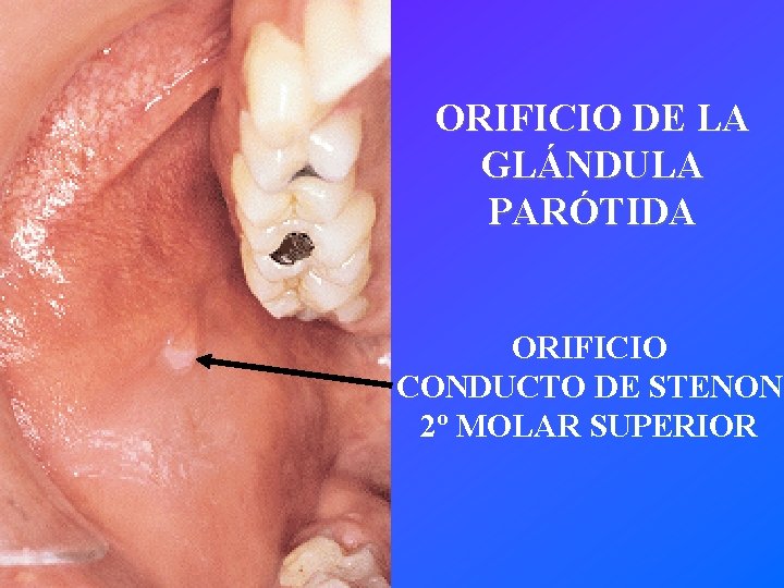 Tema 4 1 Vsceras de Cabeza y Cuello