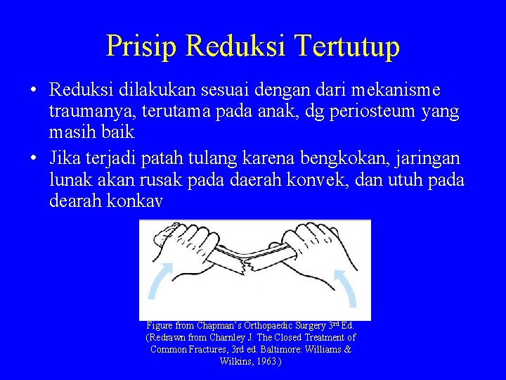 Reduksi Tertutup Tehnik Traksi Bidai dan Casting Dr