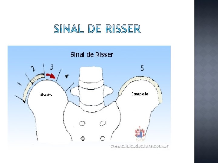 ASPECTOS RADIOLGICOS A coluna vertebral vista de perfil