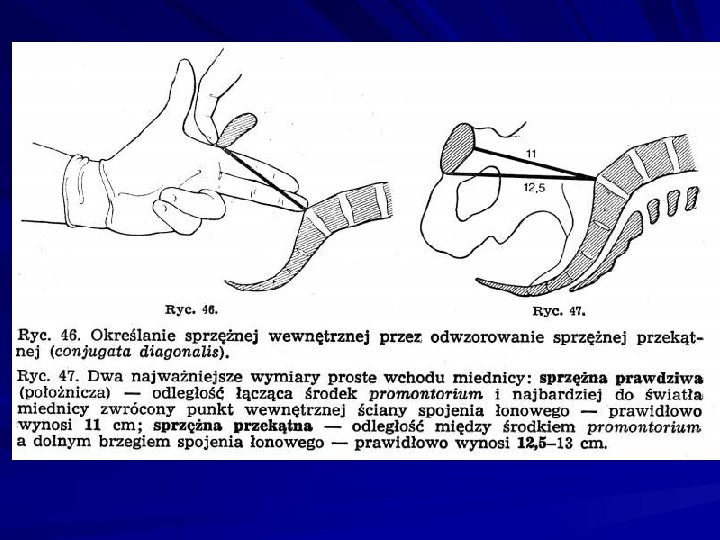 PORD FIZJOLOGICZNY ANATOMIA POONICZA MIEDNICA KOBIECA Ko krzyowa