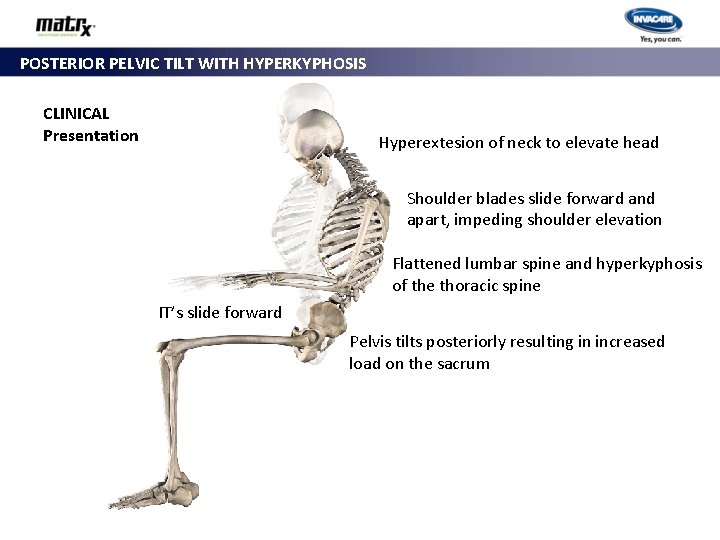 Dedicated to seating and mobility solutions Assist wheelchair
