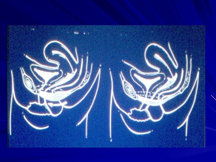 PELVIC ORGAN PROLAPS Risk Factors Pregnancy Vaginal childbirth