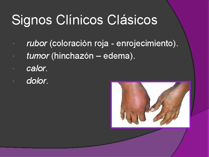 UNIVERSIDAD NACIONAL EXPERIMENTAL FRANCISCO DE MIRANDA PROGRAMA MEDICINA