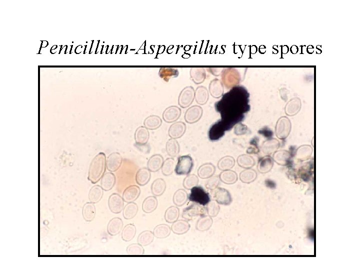 Common Fungal Spores Estelle Levetin Ph D Fungal