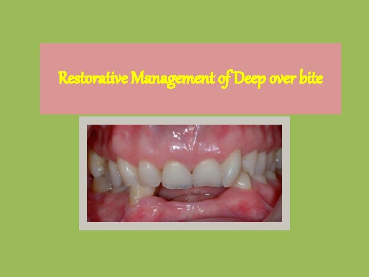 Restorative Management of Deep over bite introduction overbite