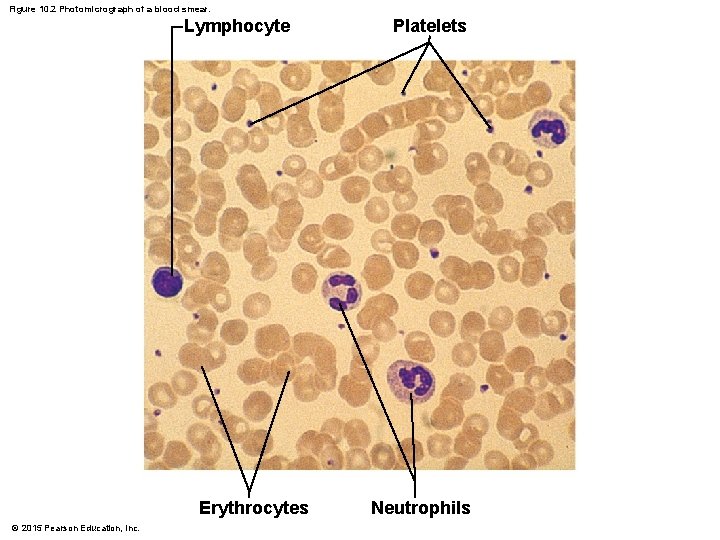Chapter 10 Blood Lecture Presentation by Patty BostwickTaylor