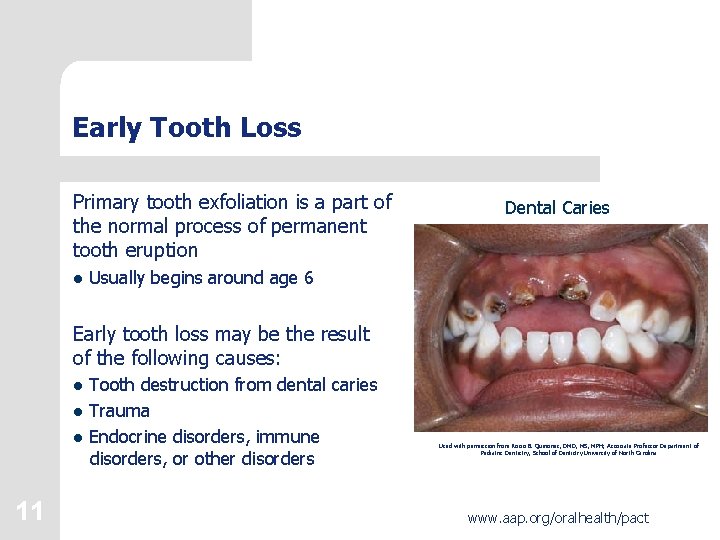 Protecting All Childrens Teeth Dental Development 1 www