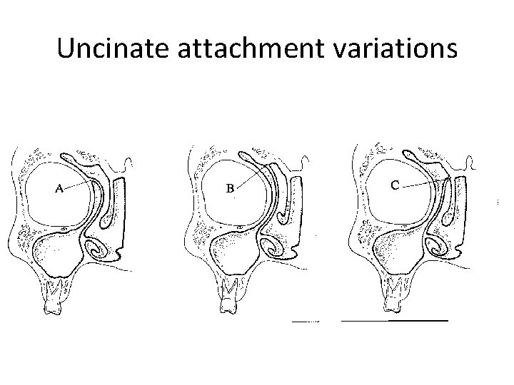 Radiology of Nasal Cavity and Paranasal Sinuses Radiology