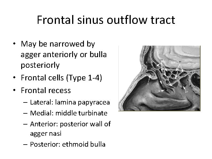 Radiology of Nasal Cavity and Paranasal Sinuses Radiology