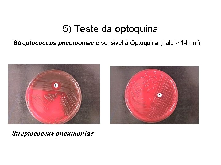 Isolamento e identificao dos Estreptococos Importncia clnica dos