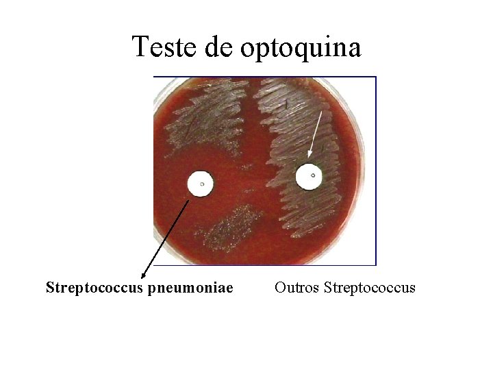 Isolamento e identificao dos Estreptococos Importncia clnica dos