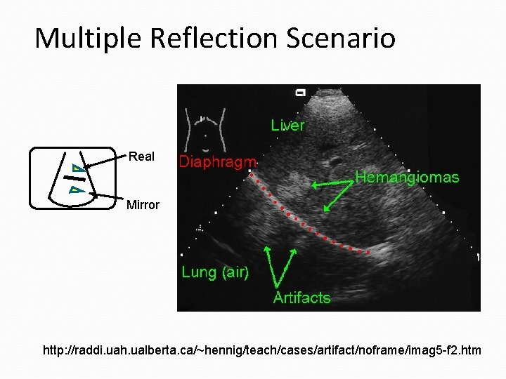 Ultrasound Physics Artifacts Hospital Physics Group George David