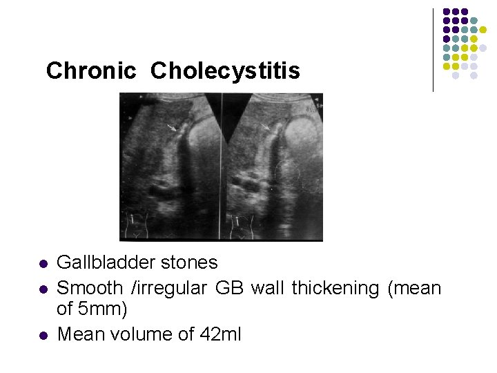 Gallbladder and Bile Ducts Chuan Lu Department of