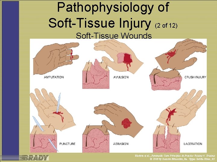 Soft Tissue Trauma Bledsoe et al Paramedic Care