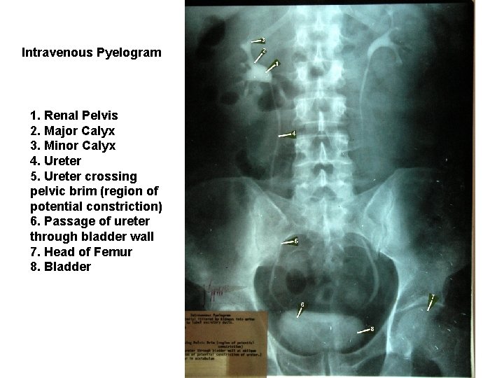 ABDOMEN AND PELVIS RADIOGRAPHS AND IMAGES XRAYS AND