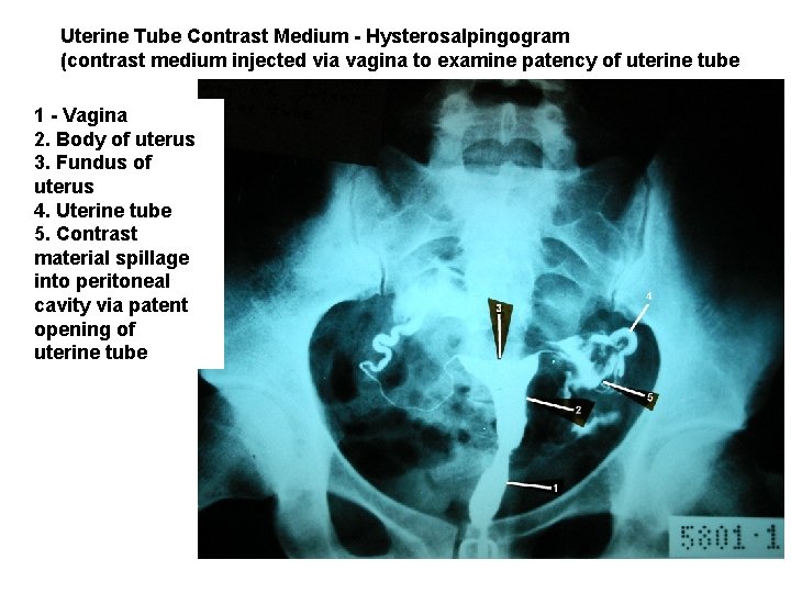 ABDOMEN AND PELVIS RADIOGRAPHS AND IMAGES XRAYS AND