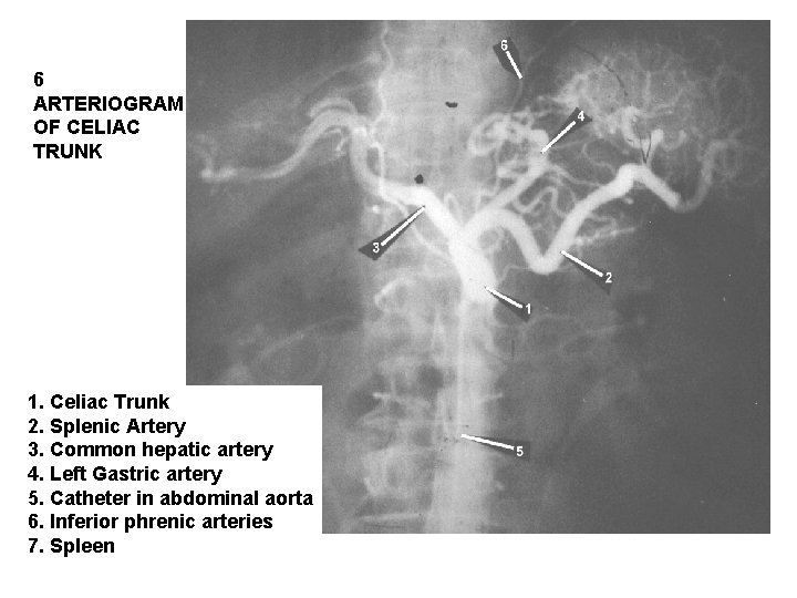 ABDOMEN AND PELVIS RADIOGRAPHS AND IMAGES XRAYS AND
