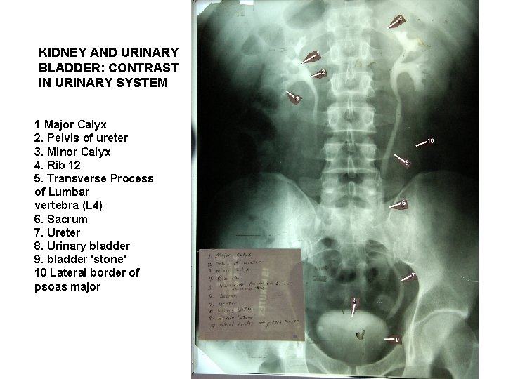 ABDOMEN AND PELVIS RADIOGRAPHS AND IMAGES XRAYS AND