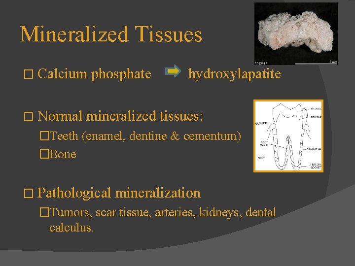 Mineralogy of Bone And its effects Osteoporosis By