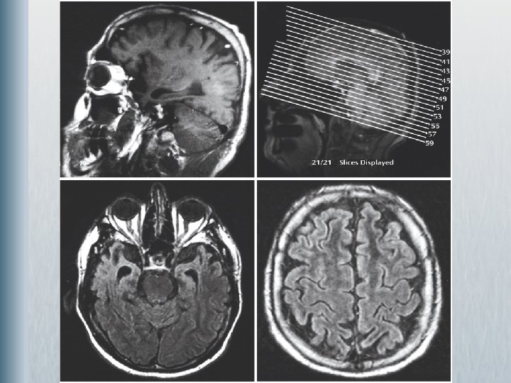 Mental Health and Older Adults Vineeth John MD